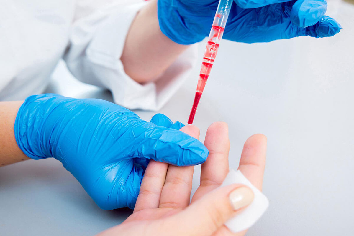 Prepare For Test - ZGen Biotech